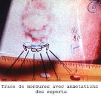 Ted Bundy (1946-1989) or the unlikely teeth bite - Histoire de l ...